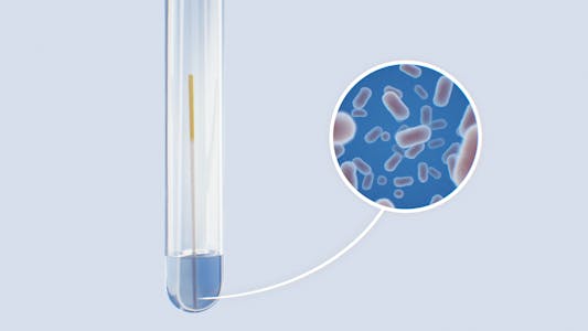 Bactéries buccales : Symptômes & Conseils pour une hygiène buccale ...