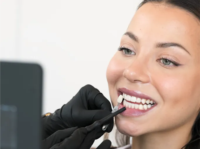 Bleaching - painless teeth whitening