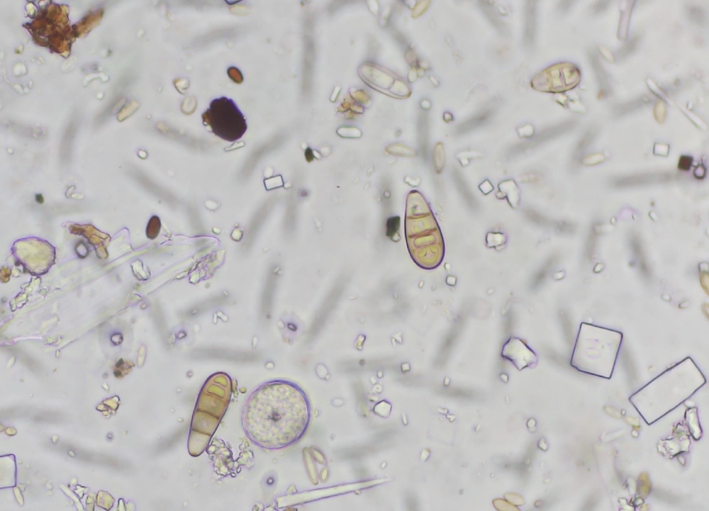 Understanding Silver Scurf Disease in Potatoes