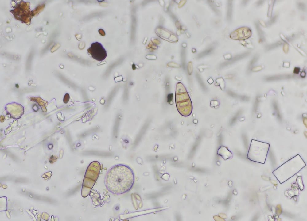 BioScout | Understanding Silver Scurf Disease in Potatoes