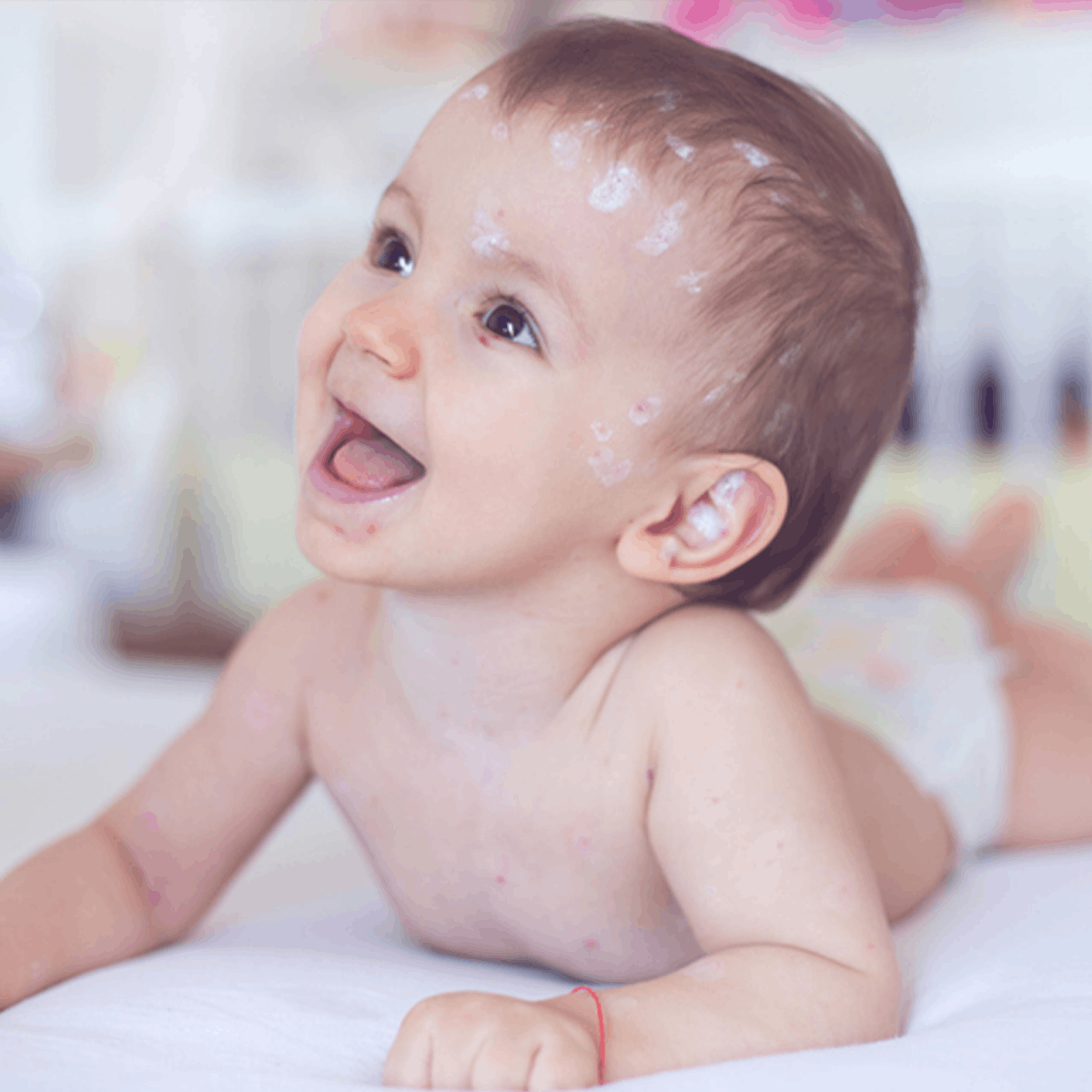 Calmer et soulager les démangeaisons de la varicelle chez l'enfant et ...