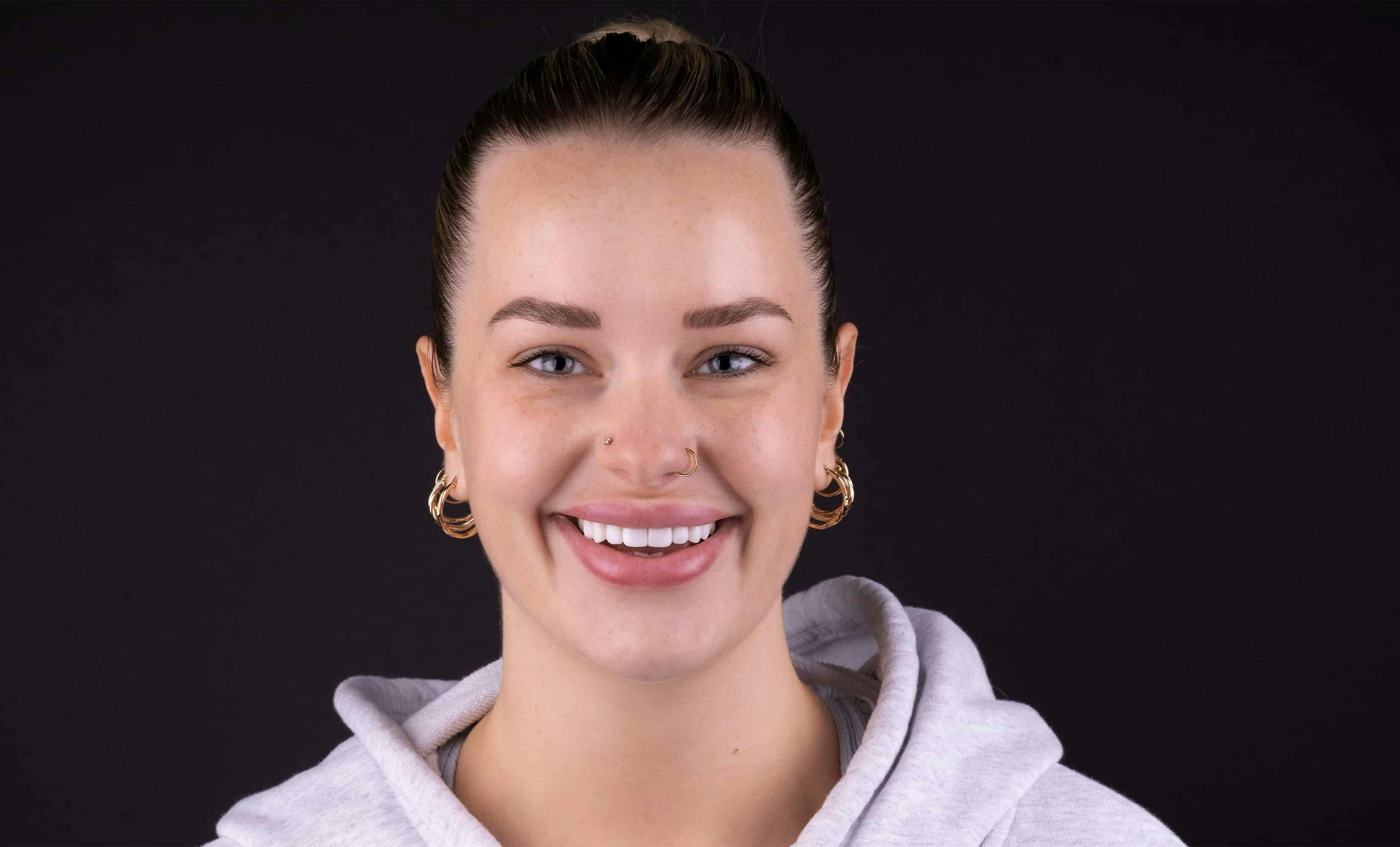 Wisdom Teeth Removal Recovery