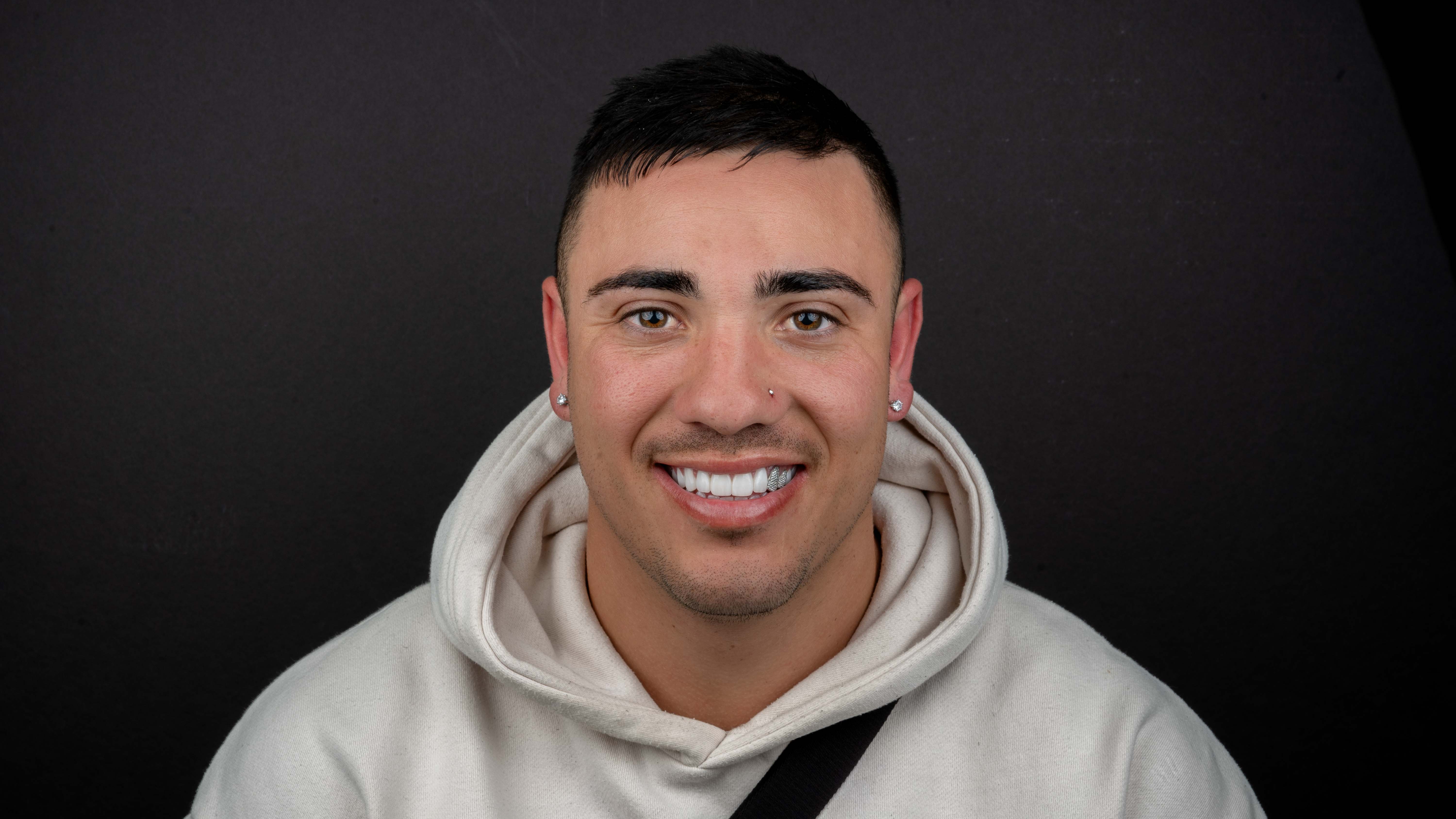 The rise of diamond veneers, crowns, and grills - Vogue Dental Studios Blog
