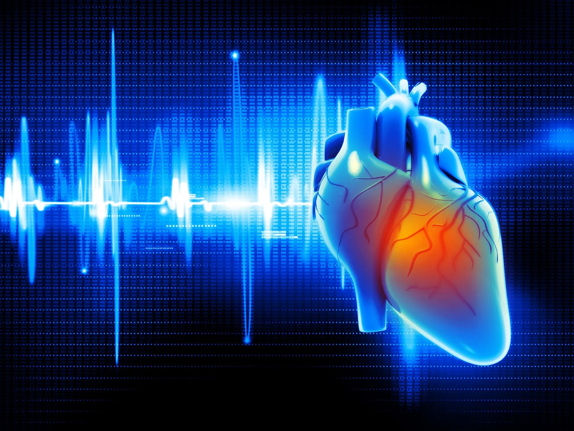 Does Medicare Cover Calcium Score Tests ClearMatch Medicare Does Medicare Cover Calcium Score Tests ClearMatch Medicare