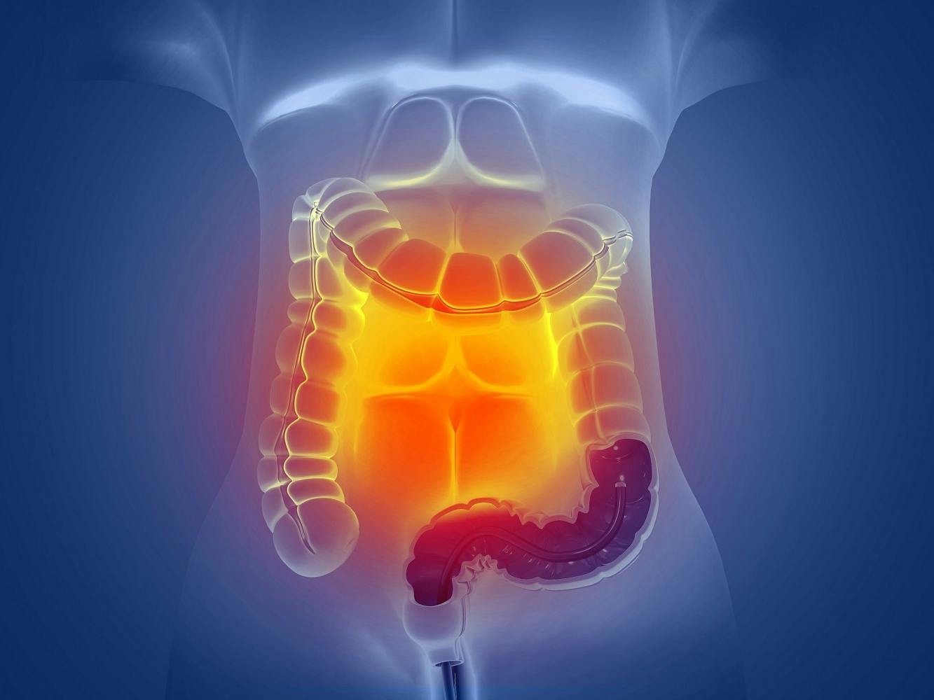 Does Medicare Cover Virtual Colonoscopy ClearMatch Medicare does-medicare-cover-virtual-colonoscopy-clearmatch-medicare