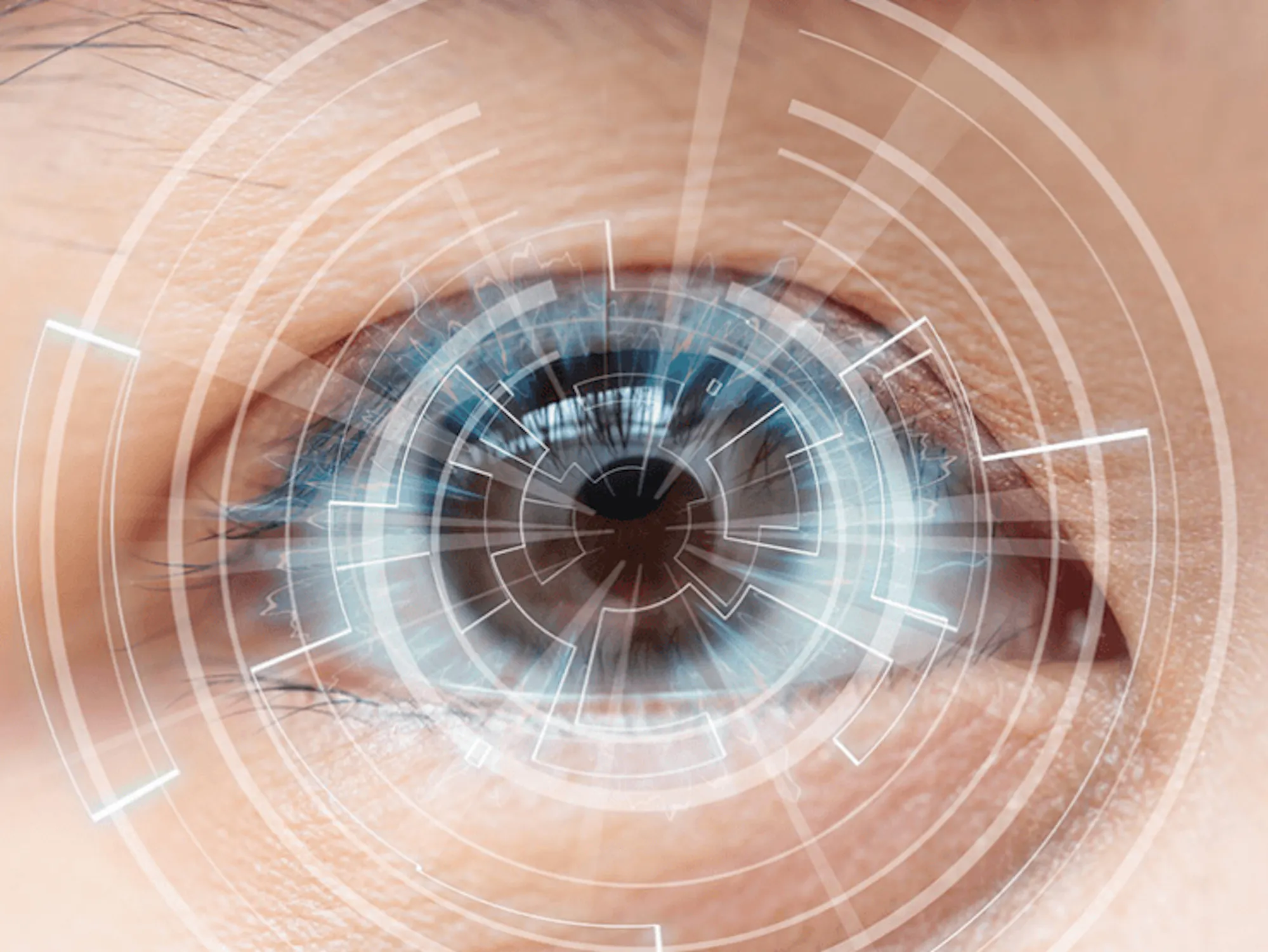 Does Medicare Cover Cataract Surgery ClearMatch Medicare does-medicare-cover-cataract-surgery-clearmatch-medicare