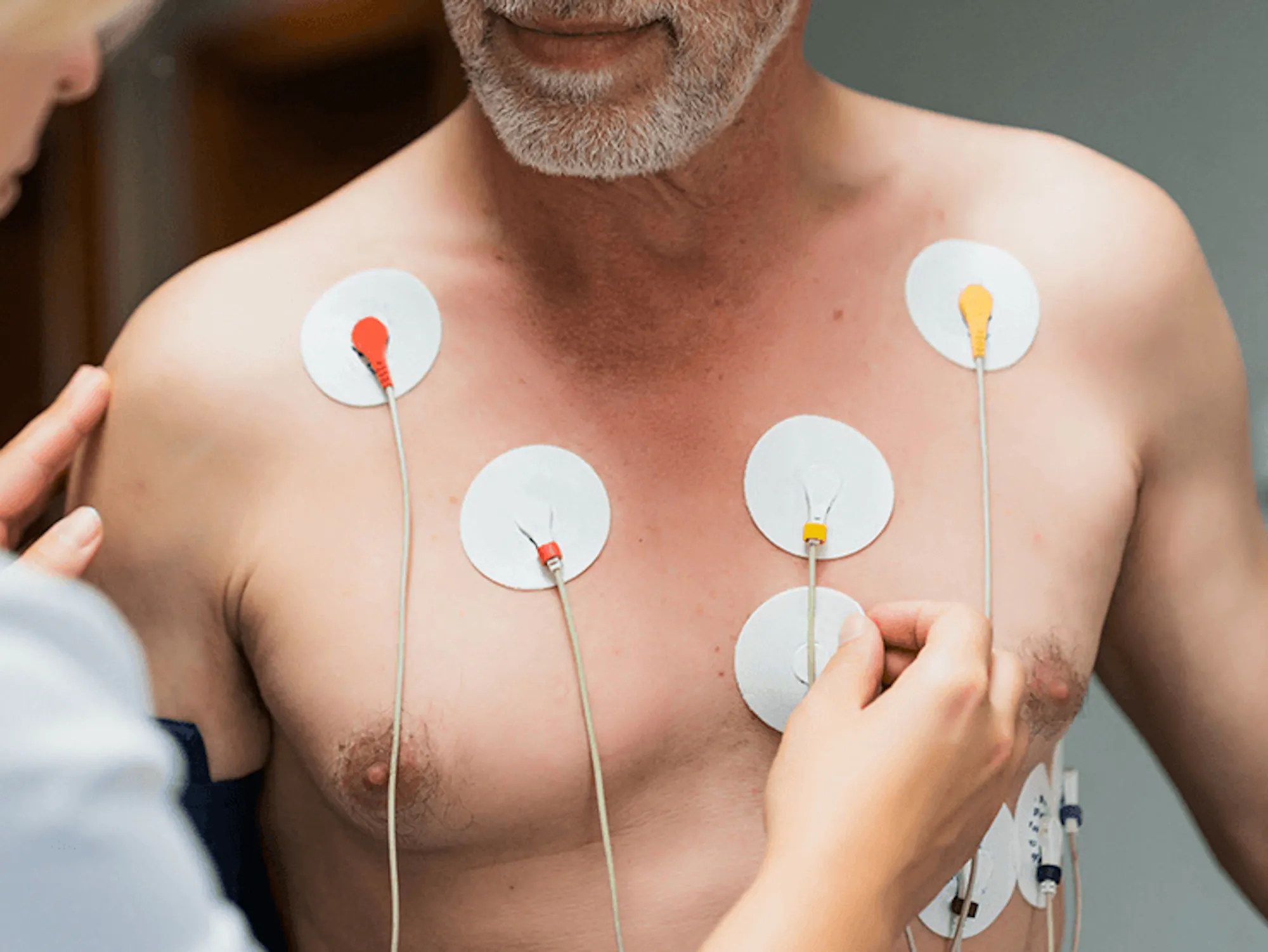 Does Medicare Cover Cardiac Stress Tests ClearMatch Medicare Does Medicare Cover Cardiac Stress Tests ClearMatch Medicare