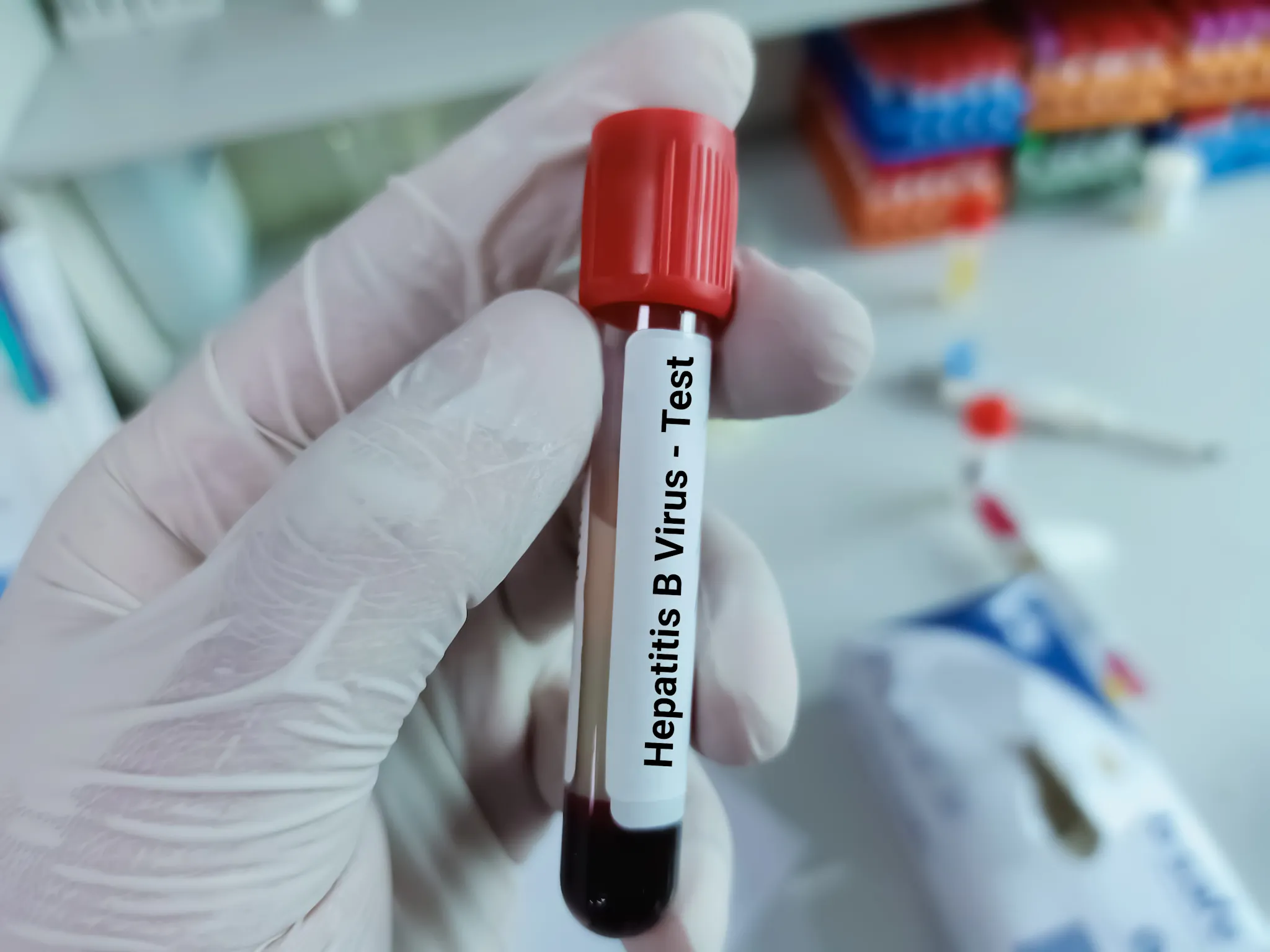 Top 5 Quickest Ways to Get Rid of a Cold Sore | CLS Health