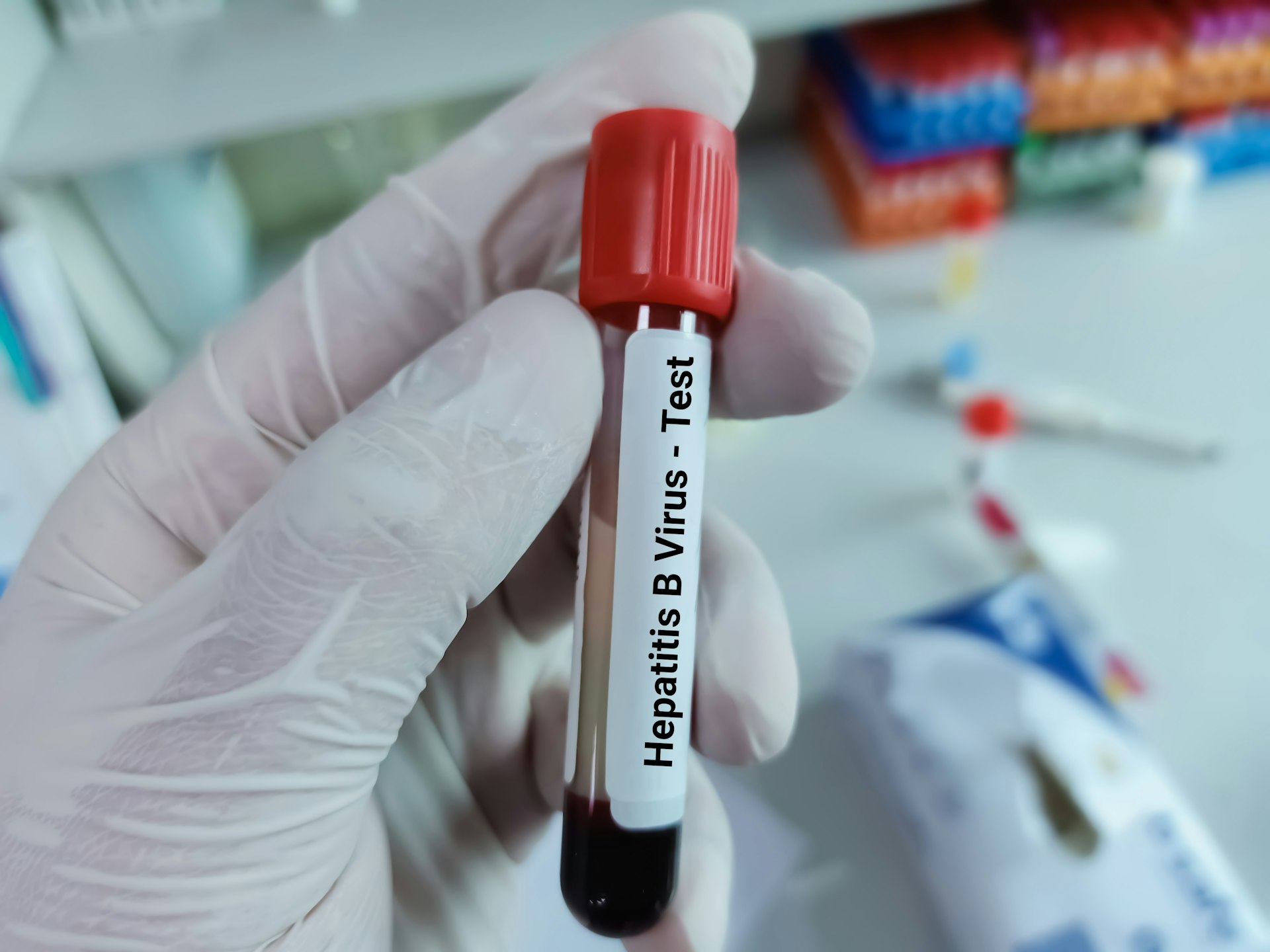 STD Testing Guidelines: How Often Should You Screen? | CLS Health