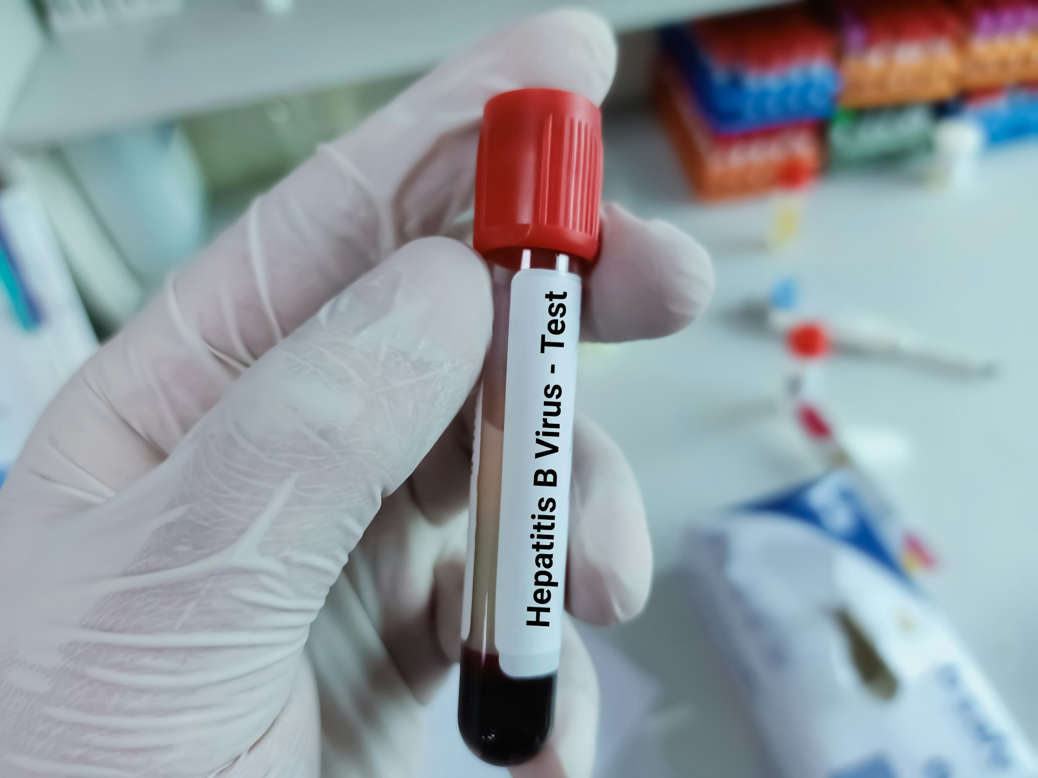 STD Testing Guidelines: How Often Should You Screen? | CLS Health