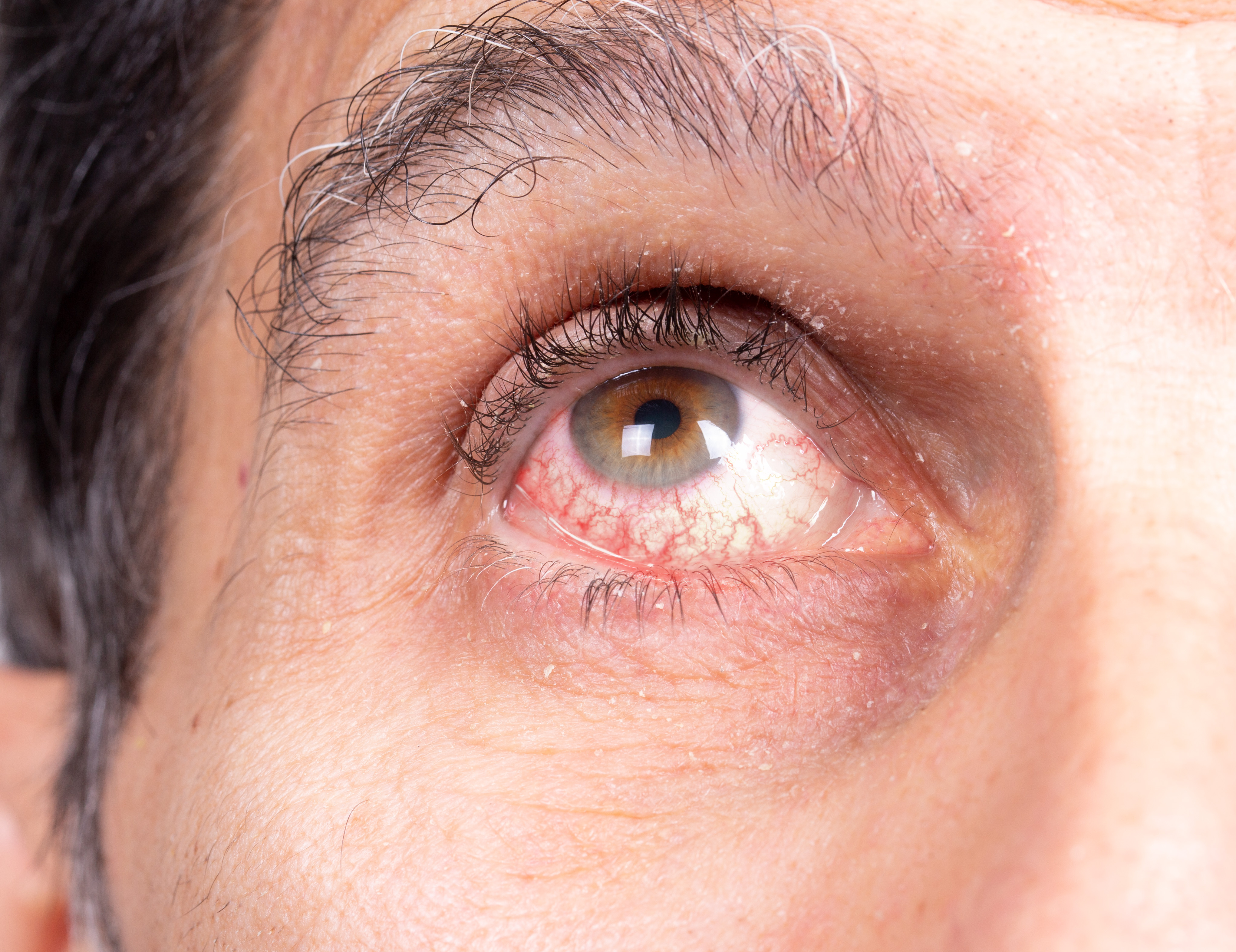 Uveitis Specialist in Houston | Clear Lake Area | CLS Health