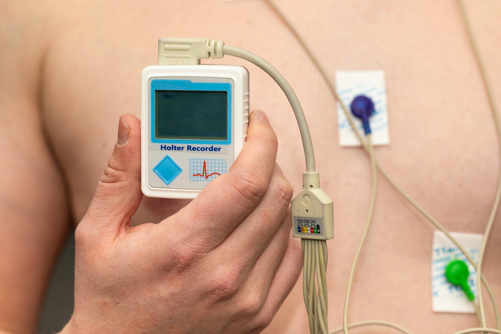 Arrhythmia Treatment in Houston | Clear Lake | CLS Health