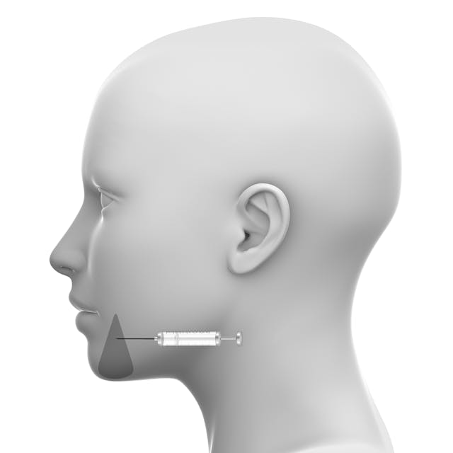 Neuromodulator Injection Techniques - Online Course
