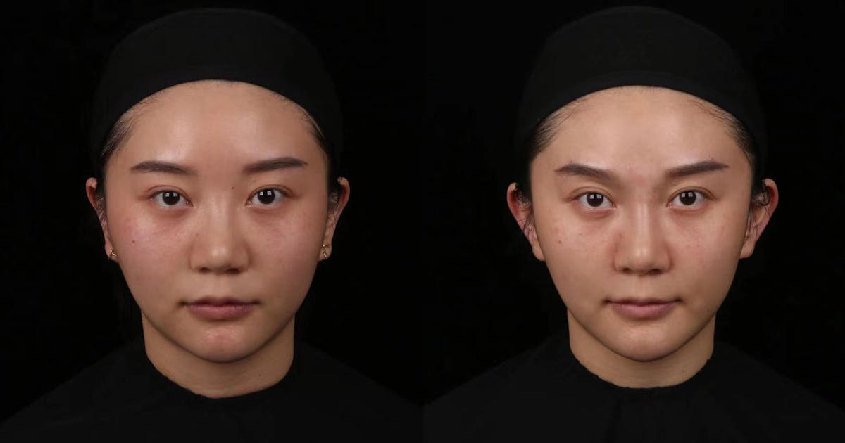 New Research: Lateralizing Auricles | Cotofana Anatomy