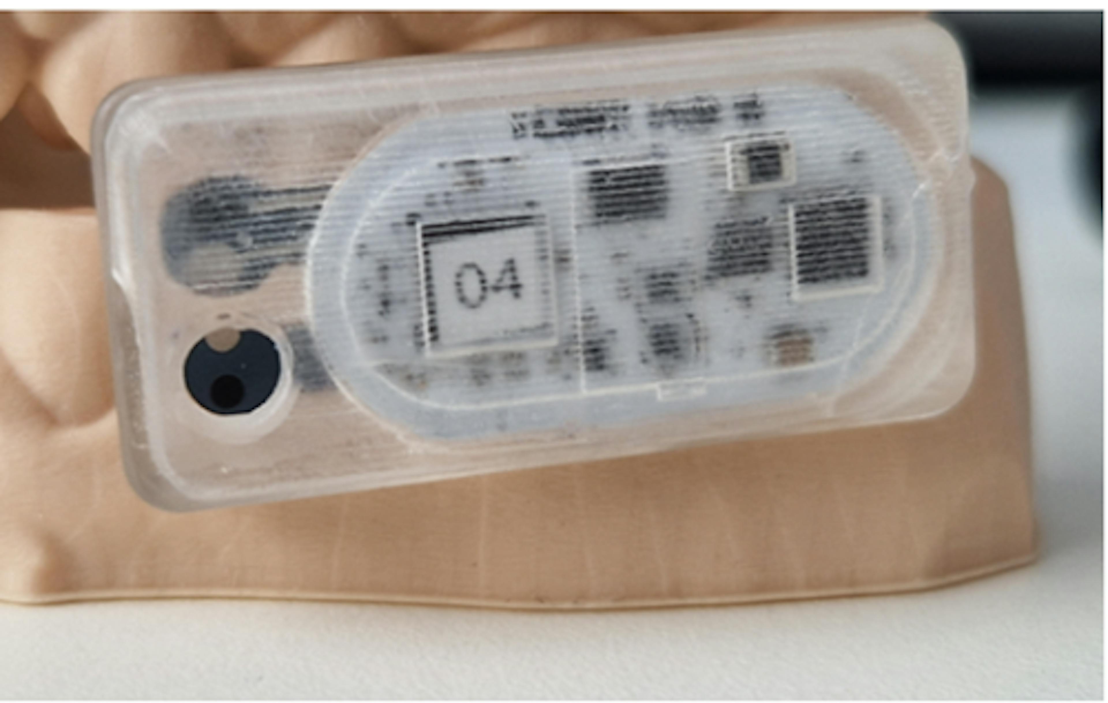 In-Mouth Wearable Biosensors for Real-Time Health Monitoring