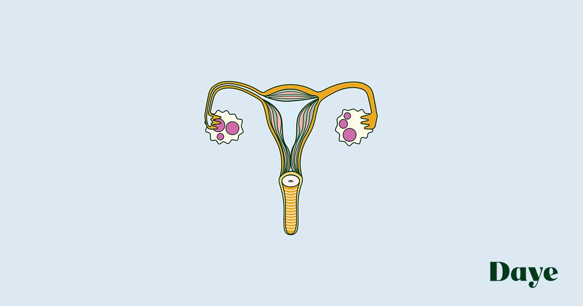 Everything About PCOS: Causes, Symptoms & Treatment