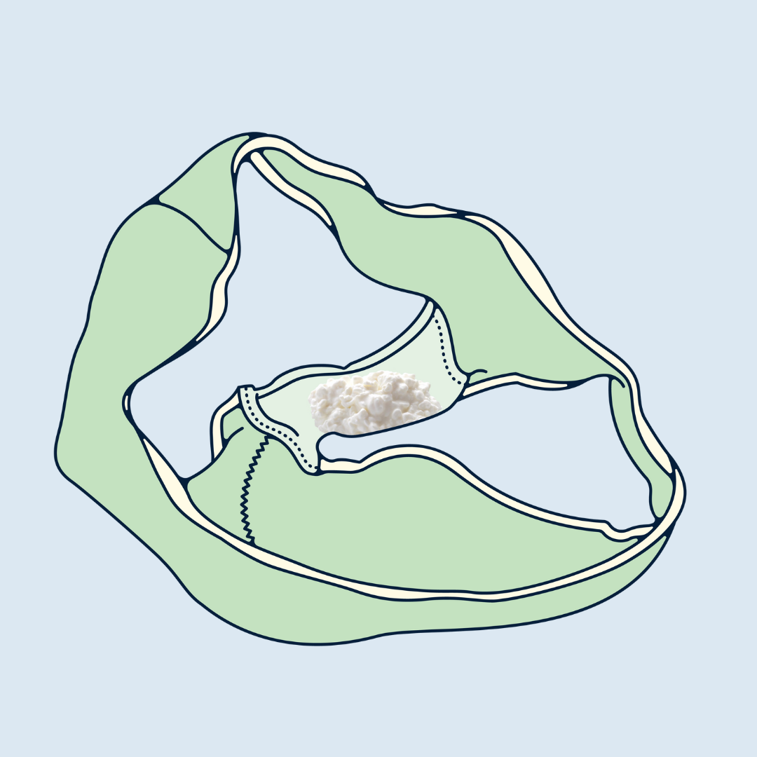 I’ve had thrush for the past three years