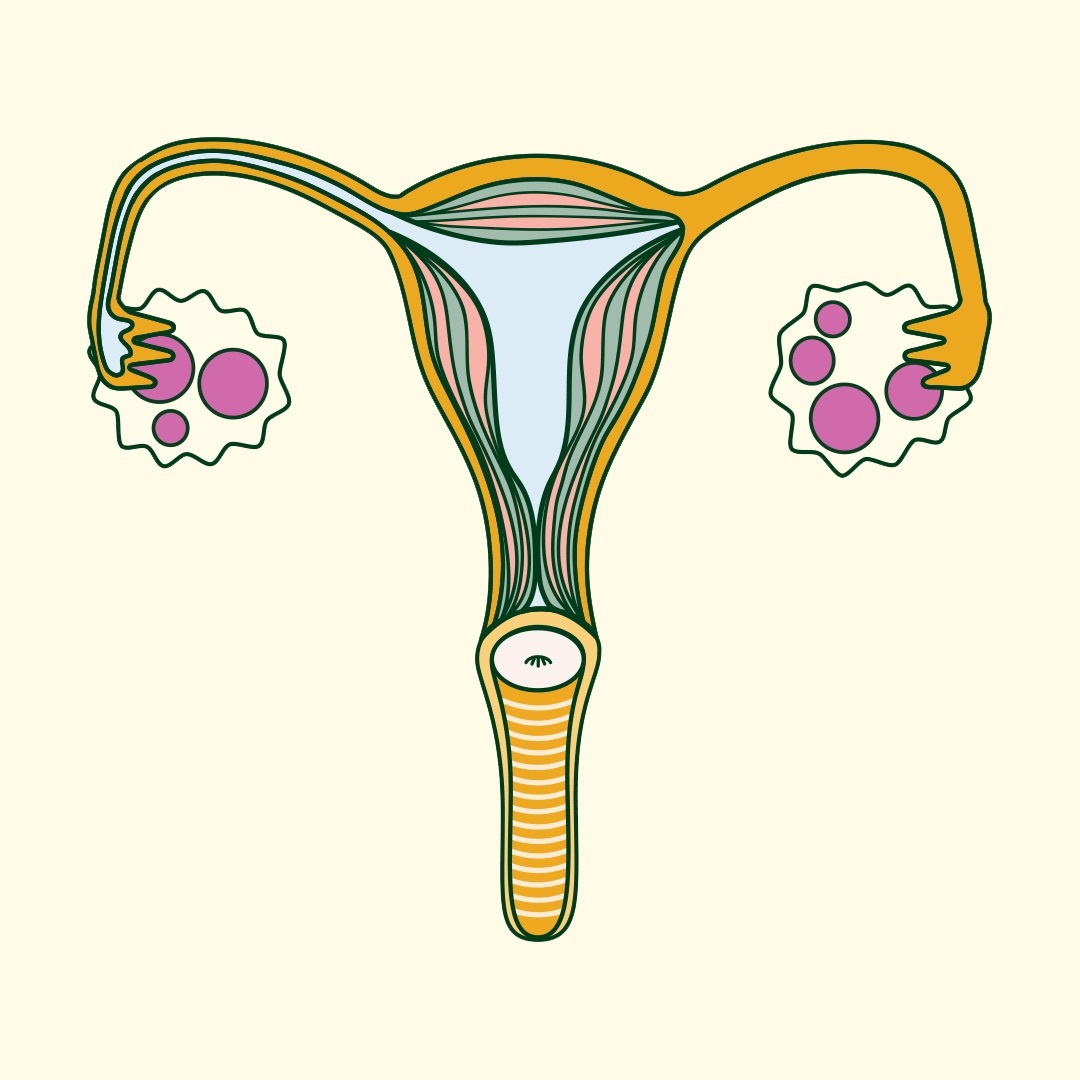 Is It Time To Change The Way We Discuss And Diagnose PCOS?