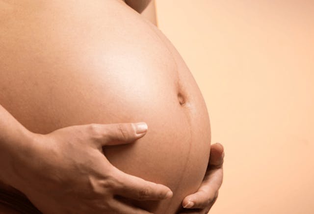 Eczema is common during pregnancy. Here’s what you can do.