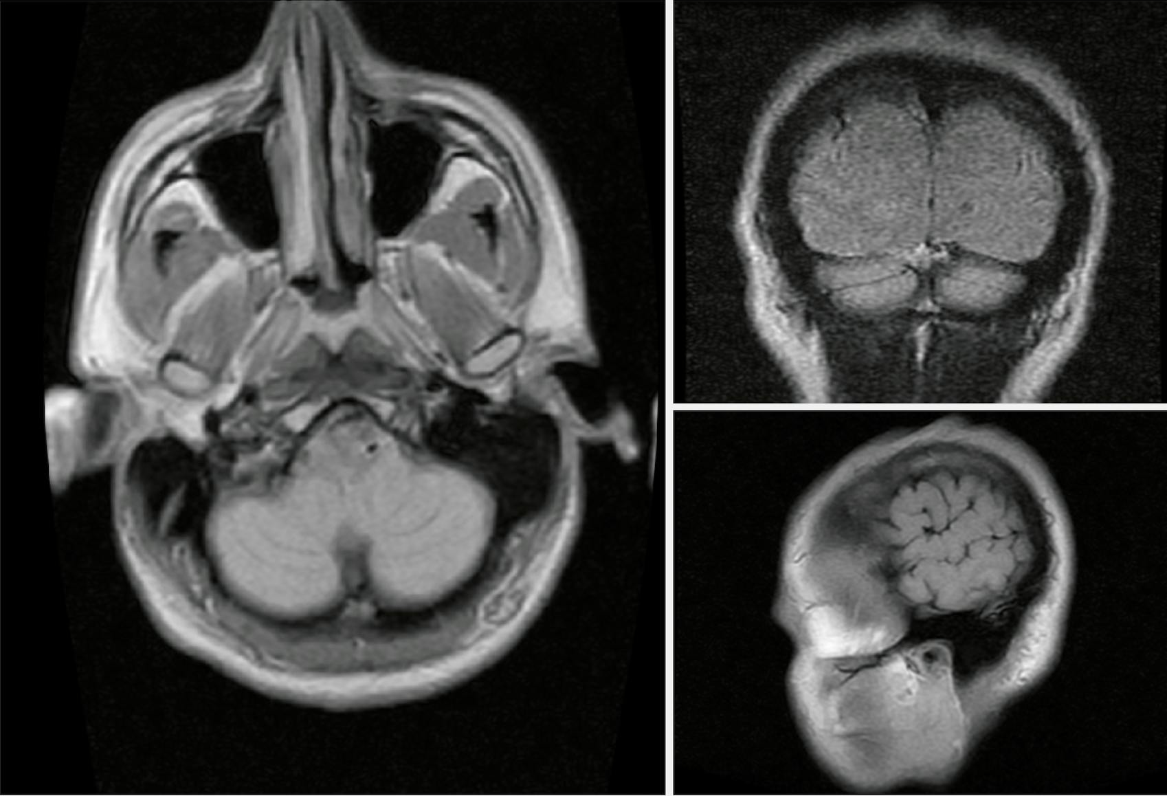 The Collaborative DICOM & NIfTI Annotation Platform for Healthcare AI ...