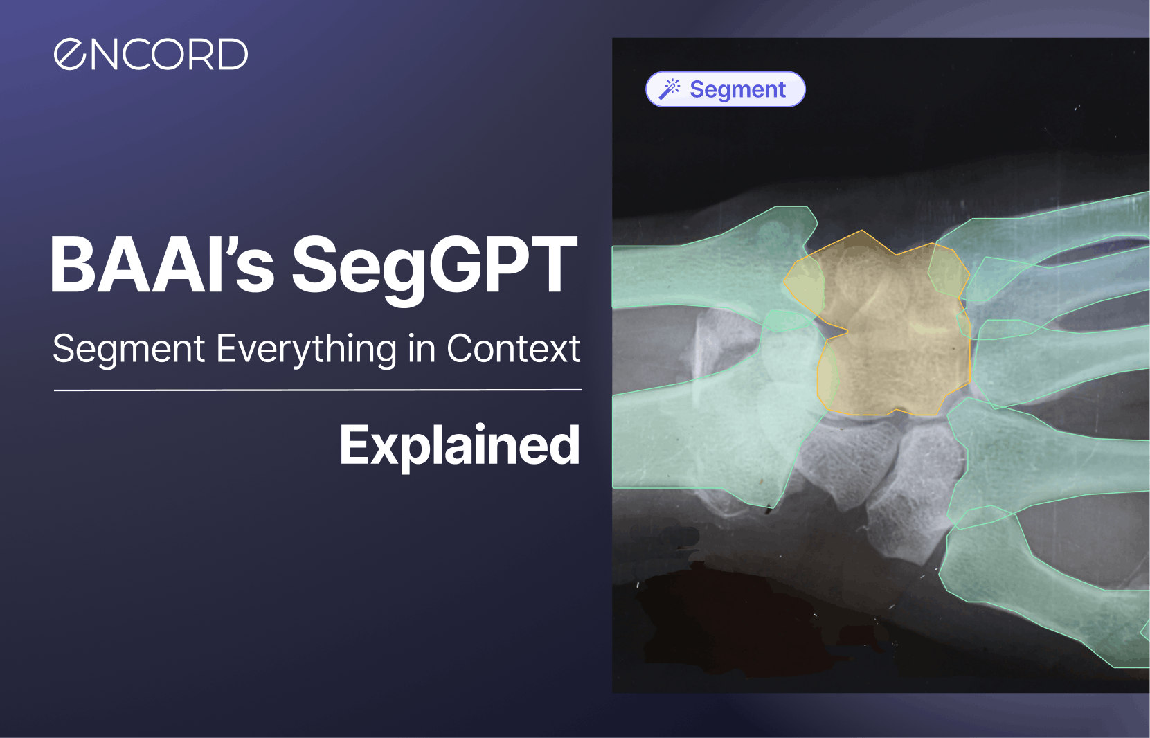 [Explainer] What is SegGPT? Segmenting everything in context applied