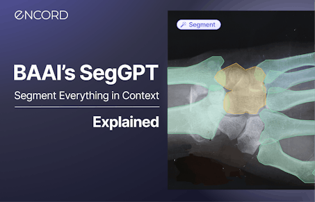 [Explainer] What is SegGPT? Segmenting everything in context applied