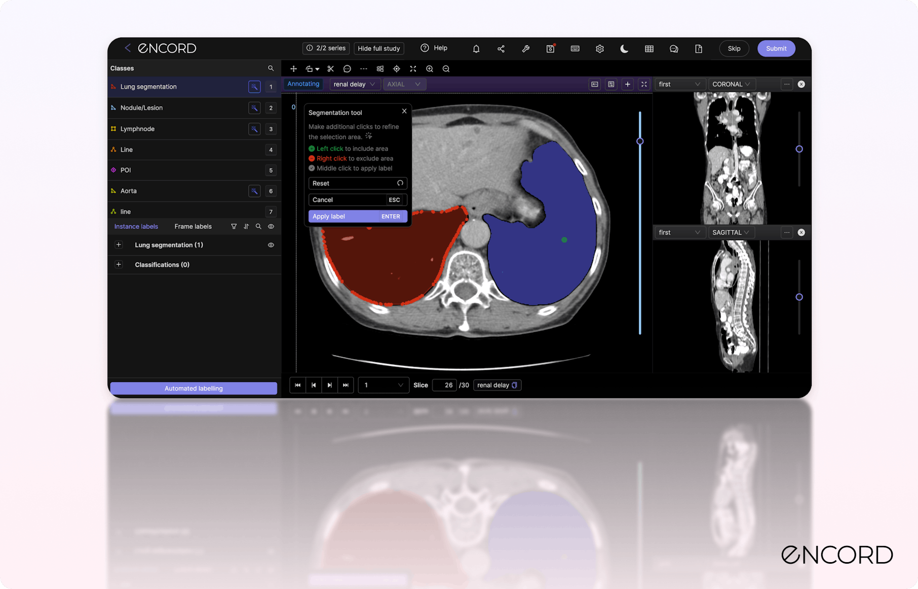 15 Best Dicom Viewers for Medical Imaging 2024 | Encord
