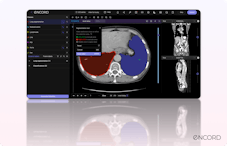 15 Best Dicom Viewers for Medical Imaging 2024 | Encord