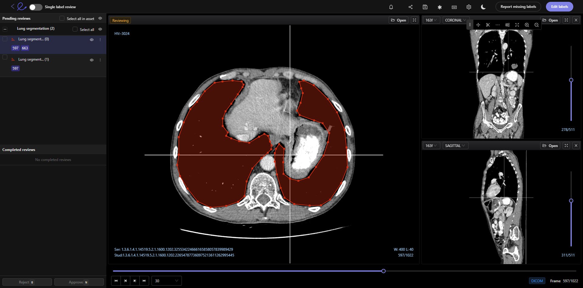 The Collaborative DICOM & NIfTI Annotation Platform for Healthcare AI ...