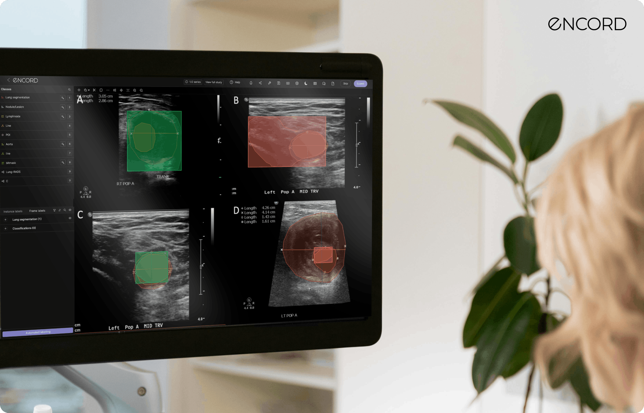 Revolutionizing Vascular Ultrasound Research: Harvard Medical School's ...