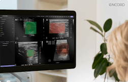 Computer Vision Customer Stories | Encord