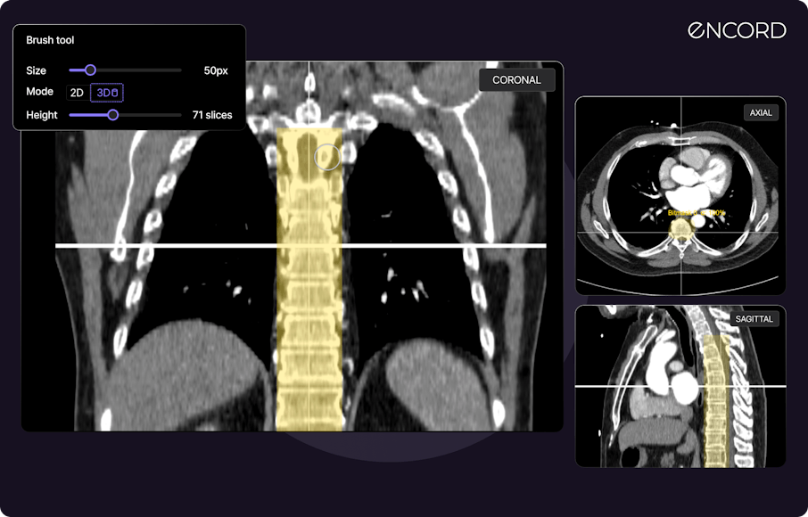 Multiplanar Reconstruction (MPR) Annotations for DICOM | Encord