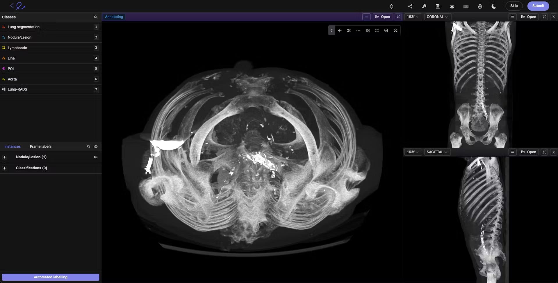 Best Open Source Dicom Annotation Tools Encord