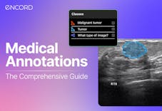 Complete Guide to Medical Image Annotations | Encord