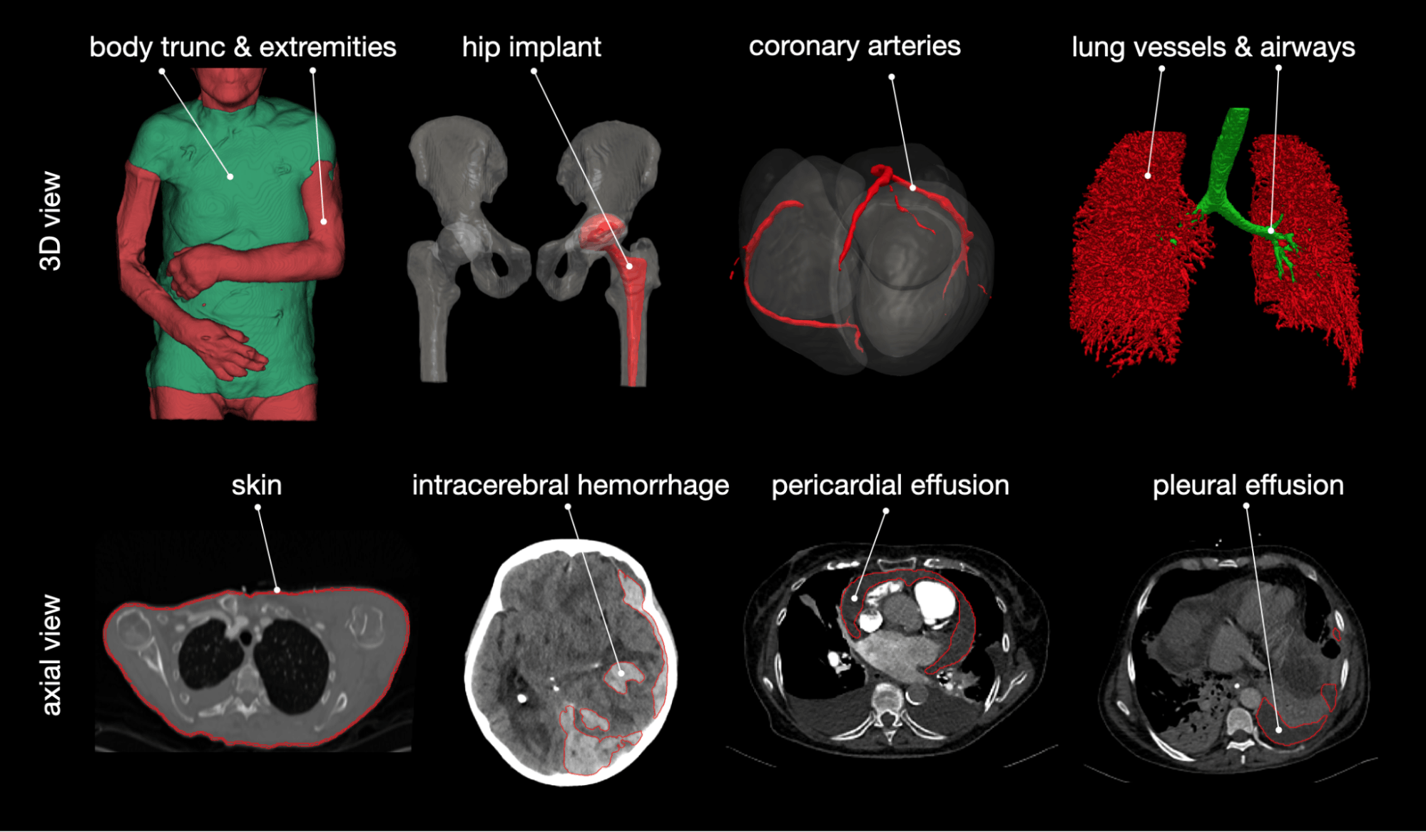 Image Segmentation Repositories from Github | Encord Image Segmentation Repositories from Github | Encord
