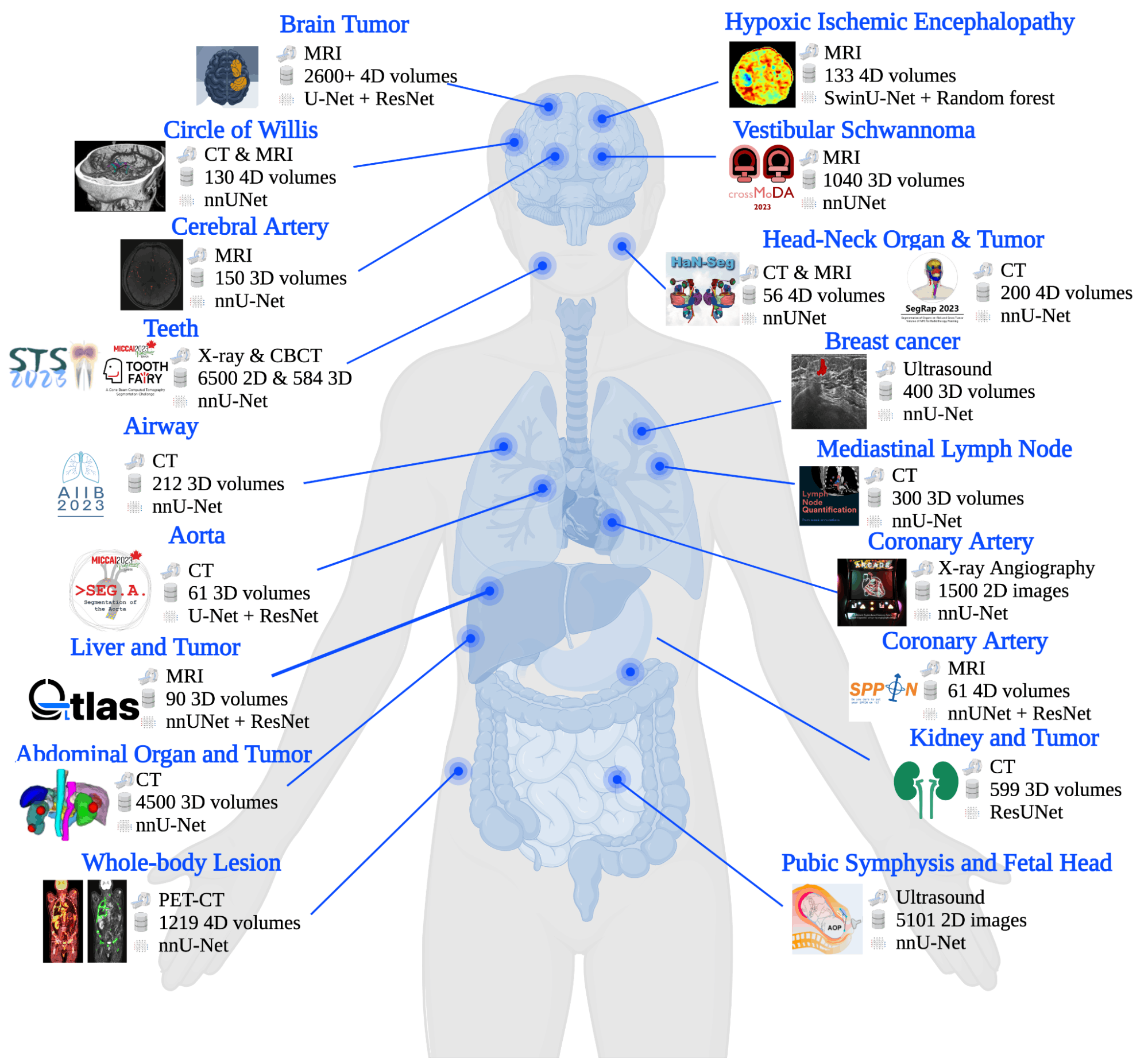 Image Segmentation Repositories from Github | Encord Image Segmentation Repositories from Github | Encord
