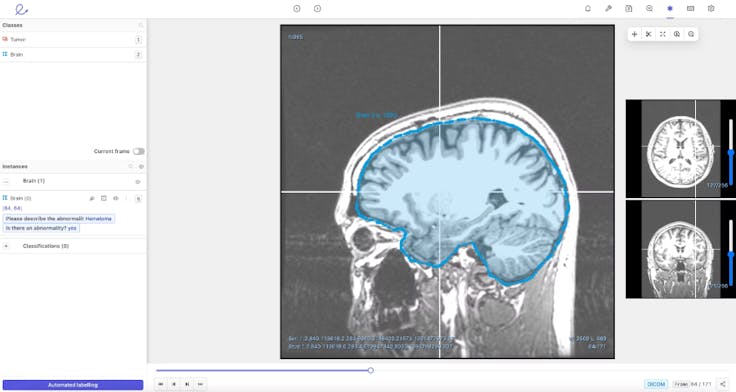 Complete Guide to Medical Image Annotations | Encord
