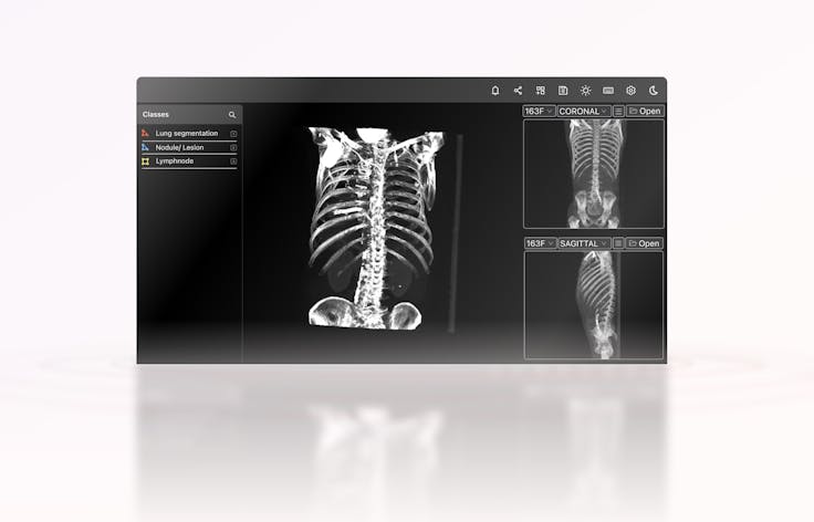 Segment Anything (SA) is now live in Encord Annotate | Encord