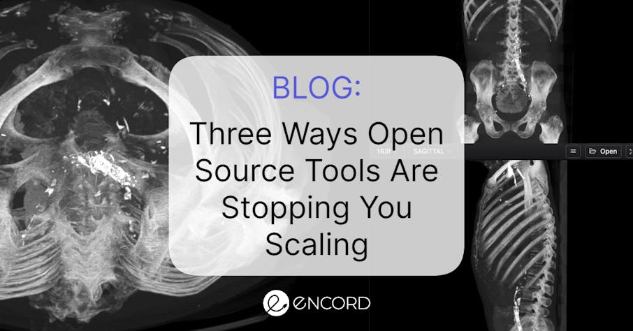 The Full Guide To Open Source Annotation Tools For Medical Imaging Encord