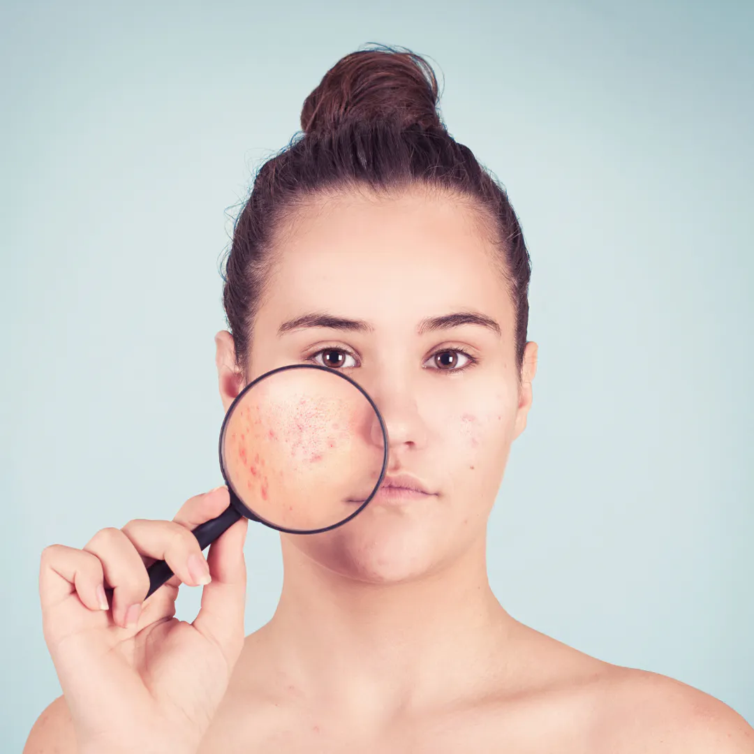 Is PCOS Treatable Experts Explain Is PCOS Treatable Experts Explain