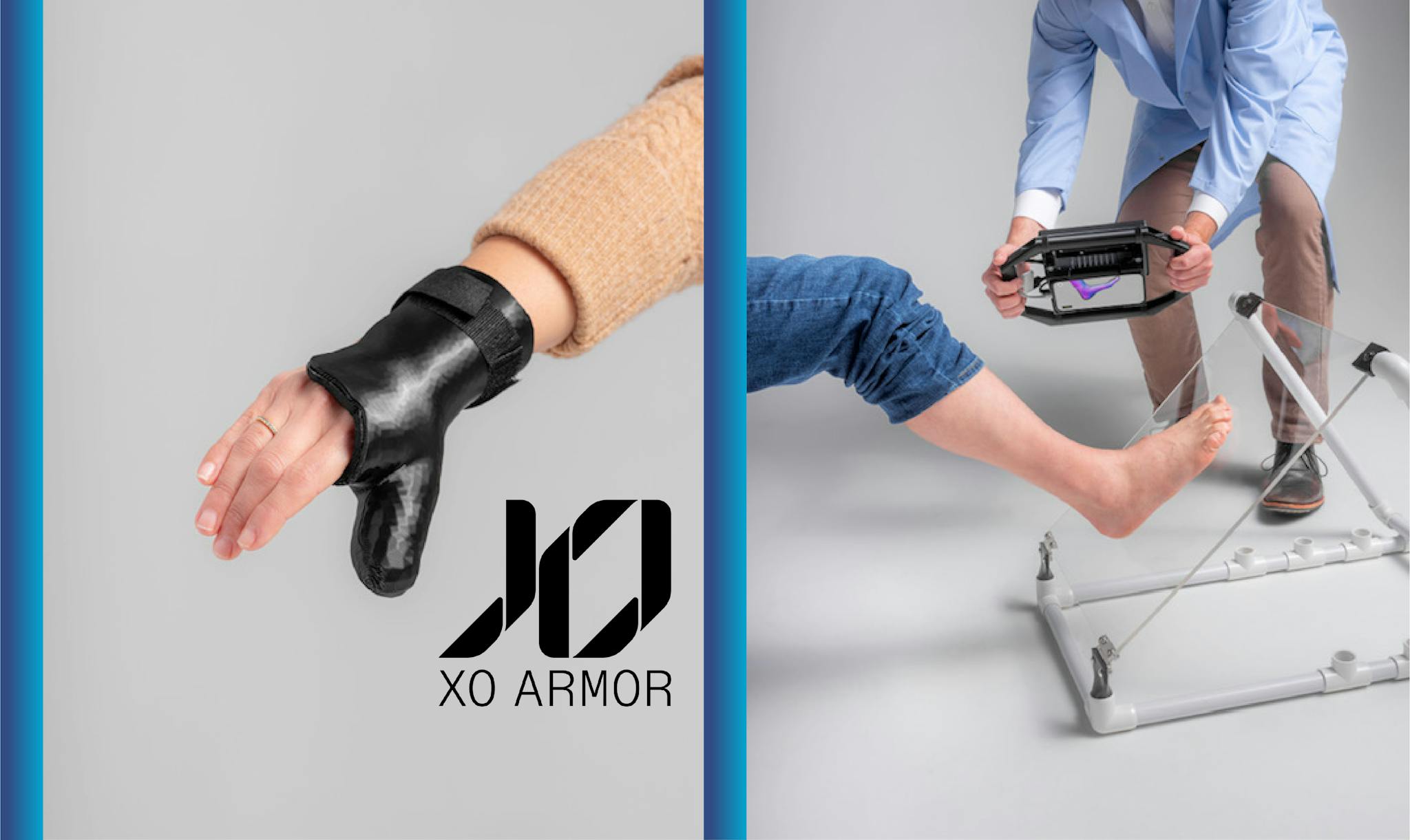 On-Site Manufacturing of DME with XO Armor | North Florida Bone & Joint ...