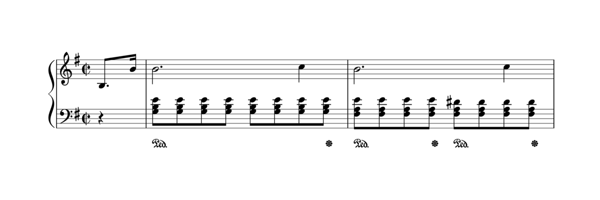 Piano Pedals » What do they do and how to use them | flowkey