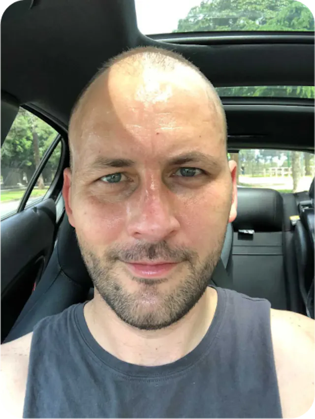 Hair Loss Treatment for Men | Mosh