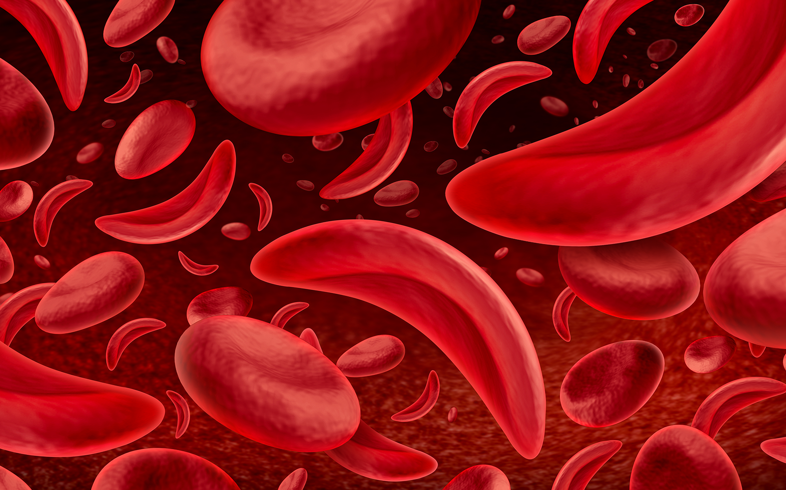 La drépanocytose | Pharmacien Giphar