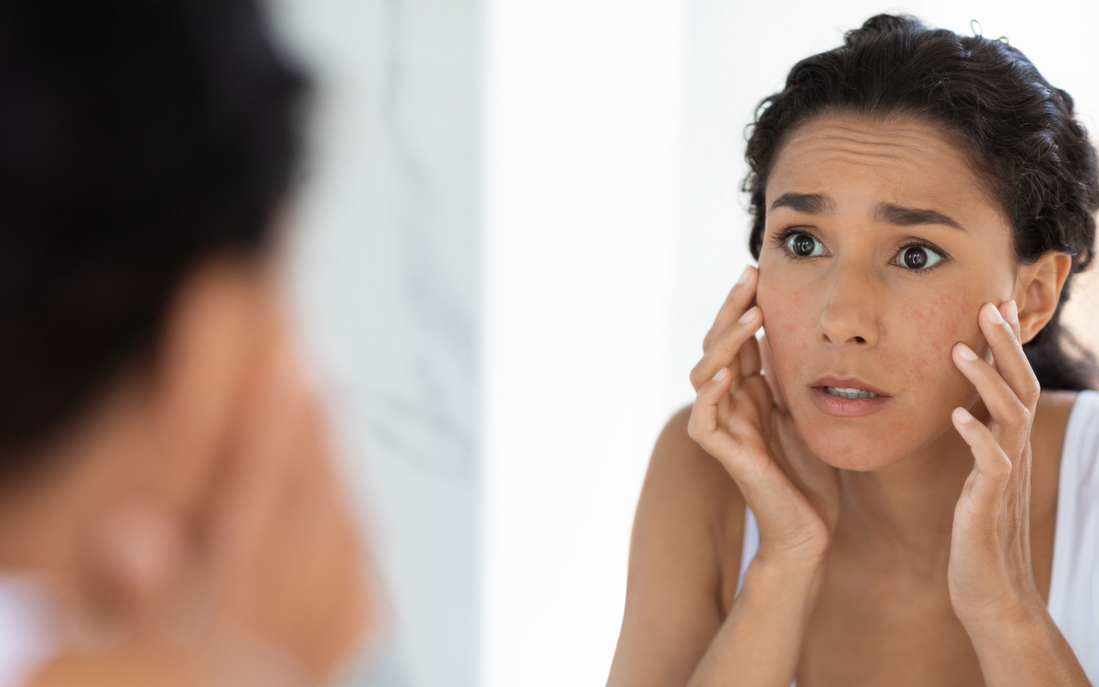 Eczéma du visage : symptômes, causes et traitements | Pharmacien Giphar