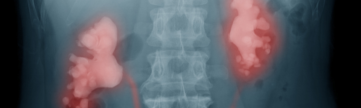 Kidney infection symptoms, common causes & treatments | GoHealth Urgent ...