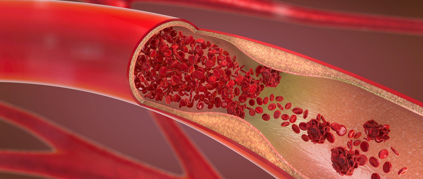 Five fast facts about anemia | GoHealth Urgent Care