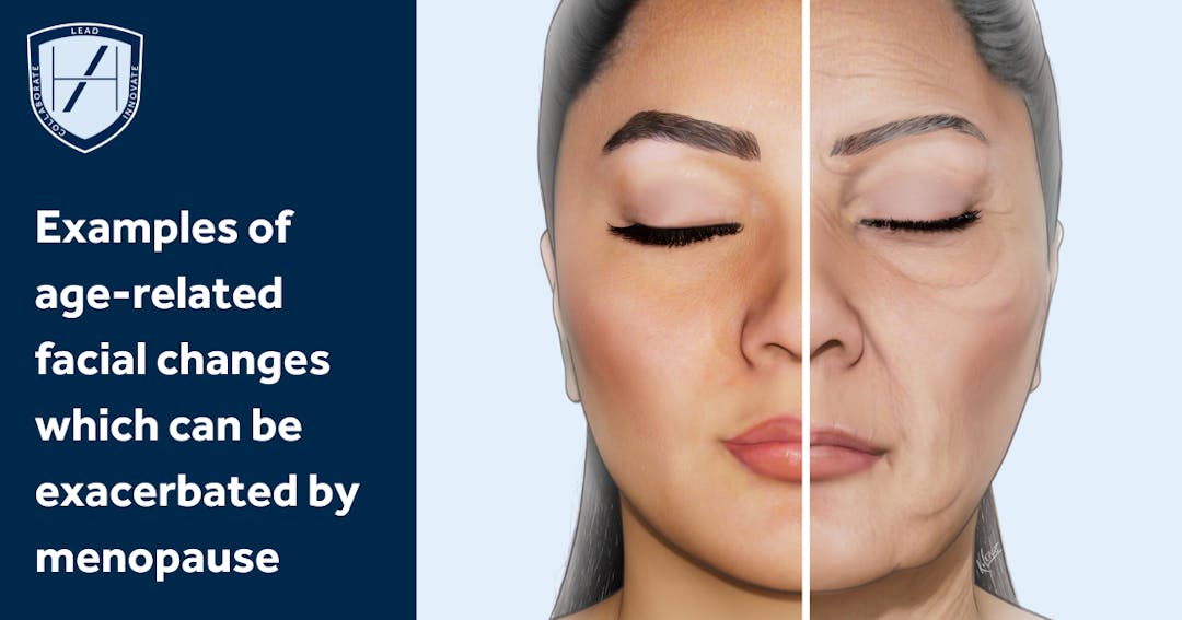 Rejuvenating Menopausal Skin: Proven Aesthetic Treatments & Techniques ...