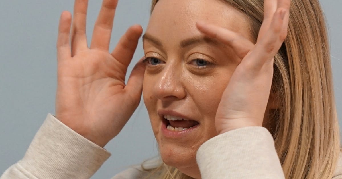 What is Jelly Roll Botox? A Guide for Aesthetic Practitioners