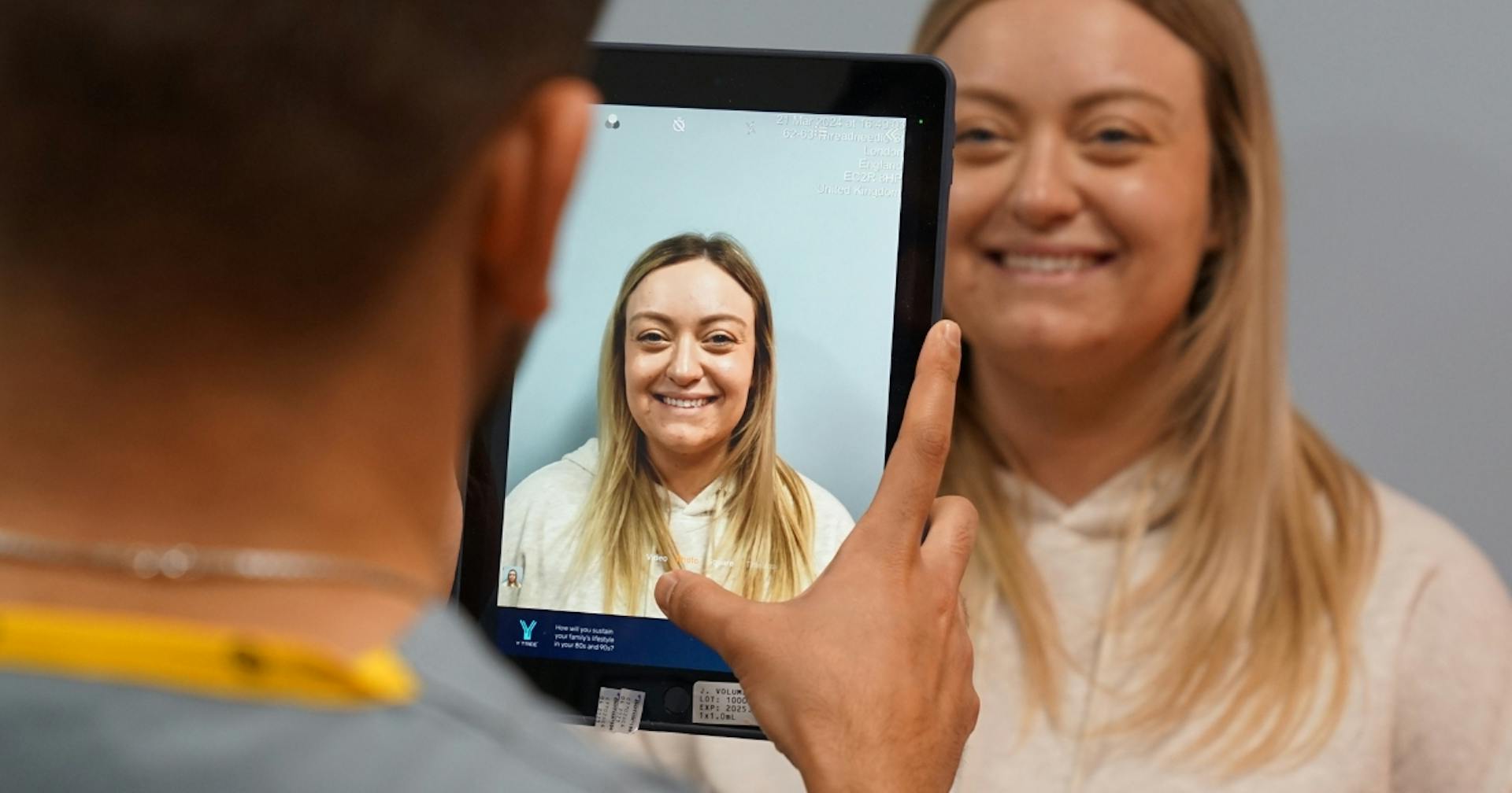 What is Jelly Roll Botox? A Guide for Aesthetic Practitioners